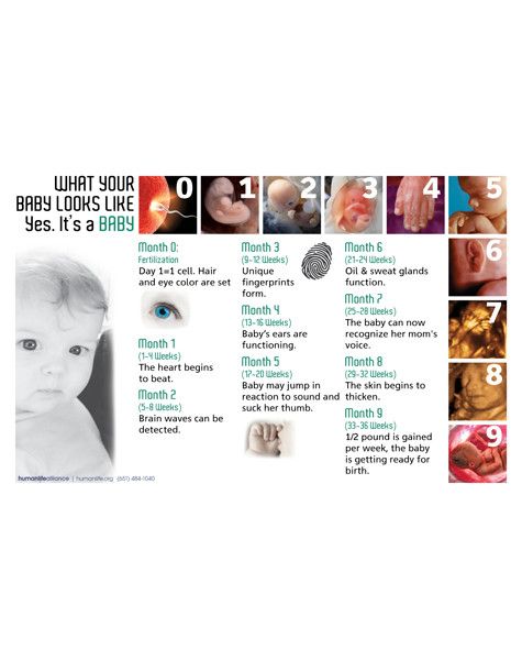 This is What Your Baby Looks Like Poster — Human Life Alliance